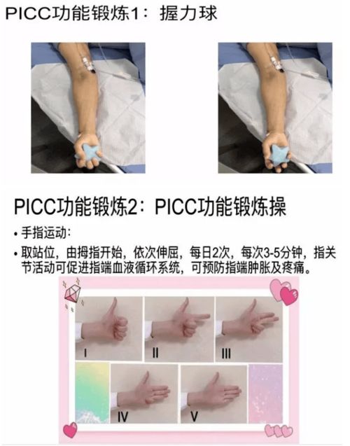 picc是什么，picc是什么保险公司_速网百科